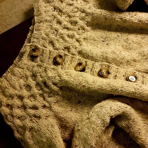 Buttons for Cardigan - Buttons for Knitting - Marble Buttons - Sweater ...