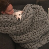 Big Yarn Giant Super Bulky Merino EPIC EXTREME Arm Knitting Kit Chunky ...