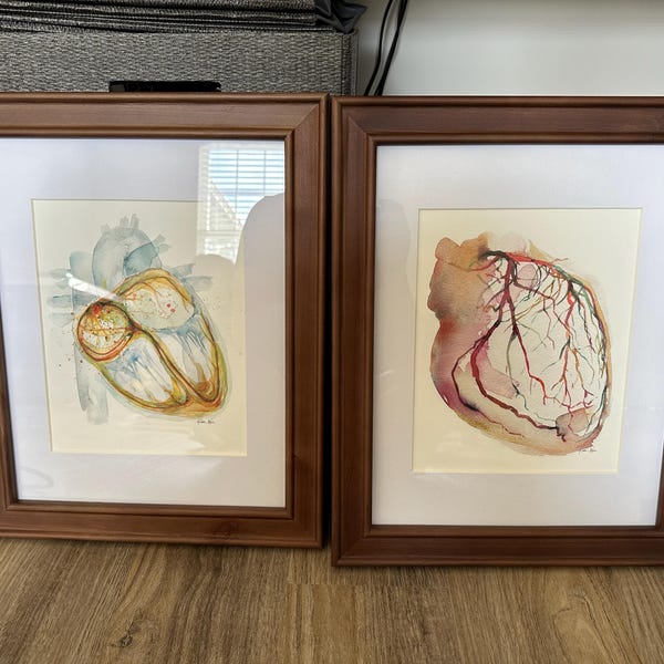 Coronary Angiogram Watercolor Print - Cardiology Painting - Heart Art ...