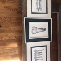 Set of 3 Blue Gray Teeth Print - Dental Art Set - Teeth Watercolor Set ...