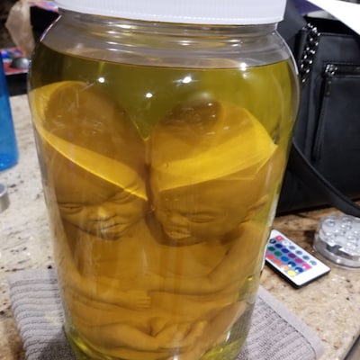 Formaldehyde Skin Siamese Twin Fetus Baby Fetal Specimen - Etsy