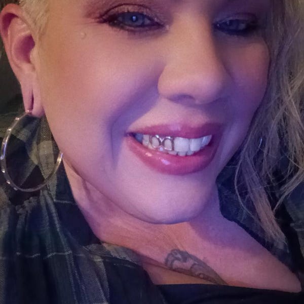 Custom Solid Gold Grillz / Permanent Cut / Deep Cut Custom Gold Grillz ...