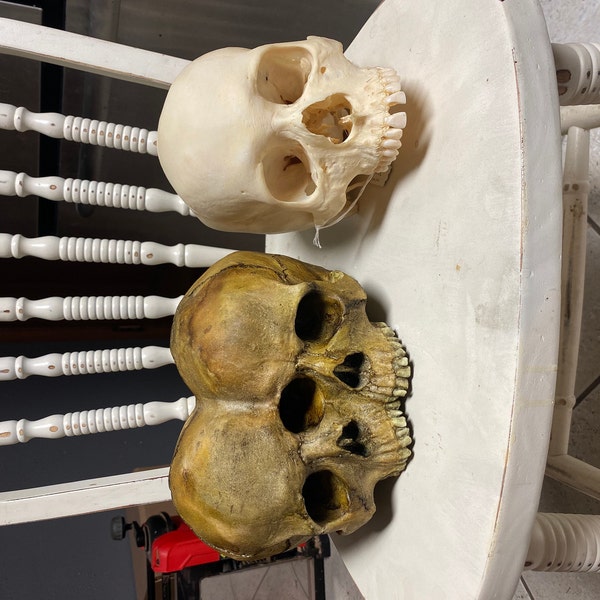 Conjoined Twins Human Skull **FREE SHIPPING* - Etsy