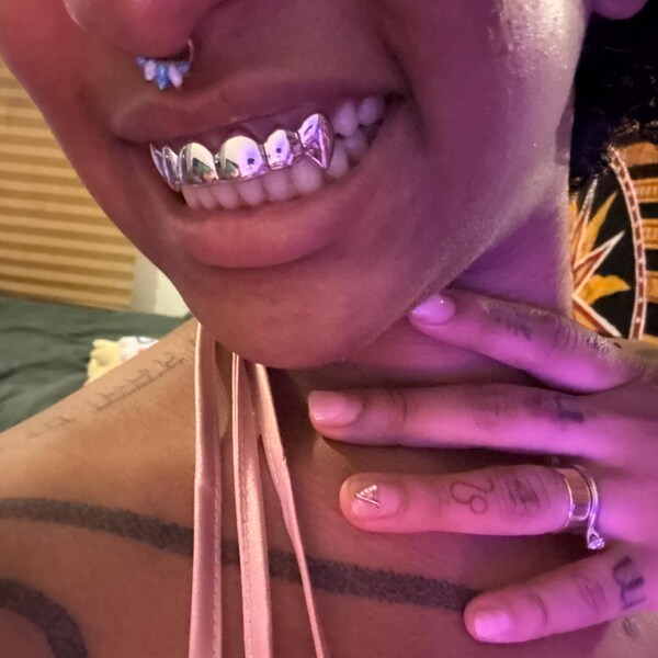 Gold Window/open Face Grillz Tooth Cap Worldwide Shipping White, Rose ...