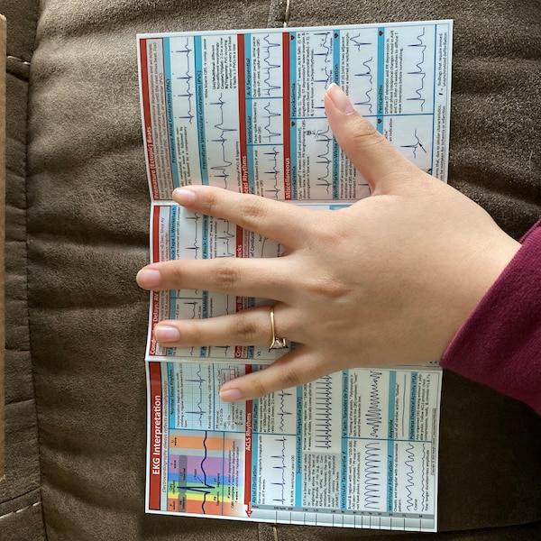 EKG Pocket Guide - Etsy