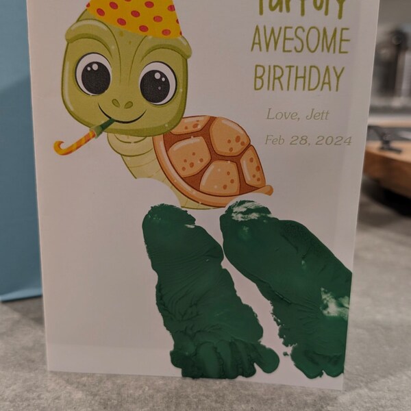 Printable Gallbladder Removal Card, Gallbladder Surgery Card, Funny ...