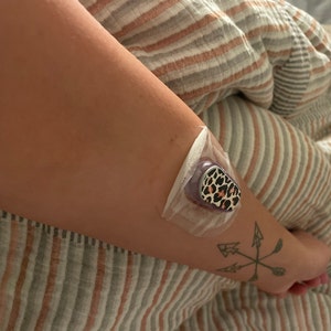 Dexcom G6 Sensor Clear Overlay Tape Bundles Dexcom Tape | Etsy