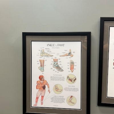 Fascia Lines Anatomy Poster SANDYSPINES Art for Chiropractors, Massage ...