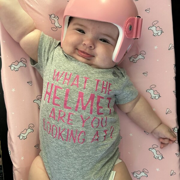 Bye Bye Helmet Hello Hair Bows - Etsy