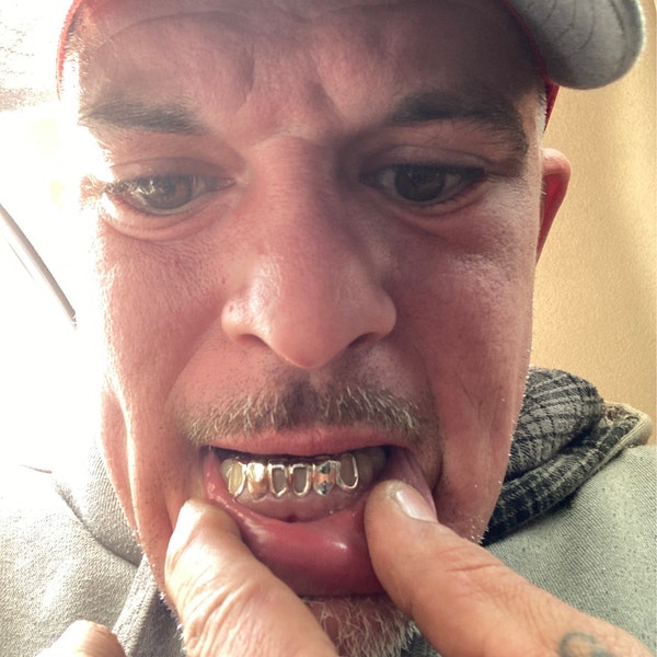 Sterling Silver Grillz 925 Custom Silver Teeth Real Open Face Silver ...