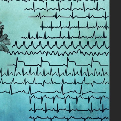 EKG Strips SVG Cardiac Monitor Nurse, Technician, Doctor Gift Digital ...