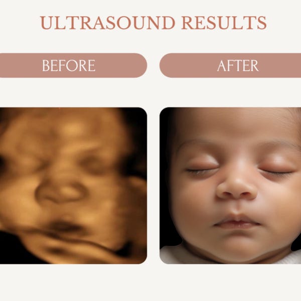 8K Enhanced Ultrasound Baby Scan: Custom 3D/4D/5D Real View - Etsy