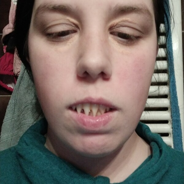 Pennywise Sharp Teeth Dentures - IT Killer Clown Cosplay Accessory for ...