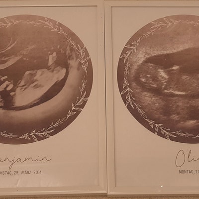 FRAMED Watercolour Baby Scan Print Art, Baby Scan Frame, Baby Shower ...