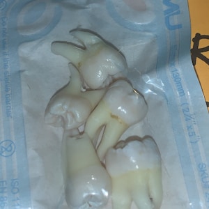 10 Real Human Teeth molars, Premolars, & Anteriors - Etsy