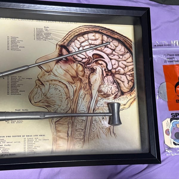 BESTSELLER! Lobotomy Shadowbox Display Large - Etsy