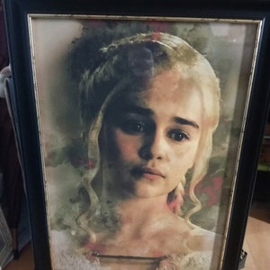 Nose Poster Human Anatomy Art ENT Specialist Gift Clinic - Etsy