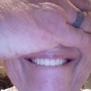 Upper Denture Sample Premade Small to Medium Size - Etsy