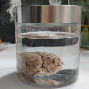 Lobotomy Shadowbox - Etsy