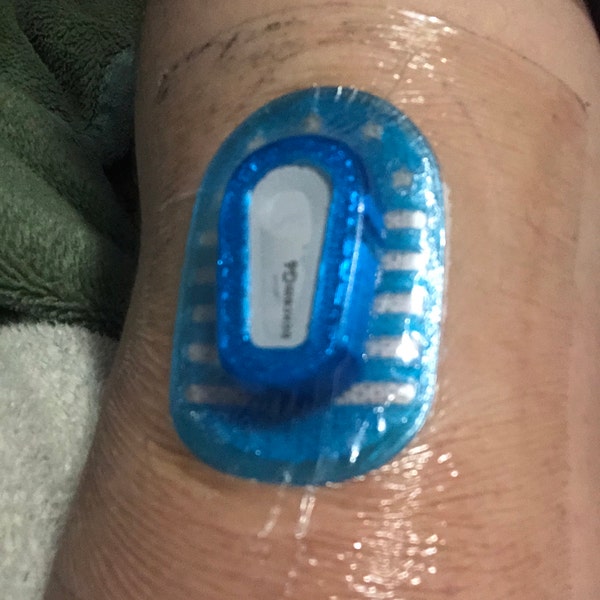 Dexcom G6 Arm Band Cover, 4-18" Adjustable Sensor Shield - Etsy