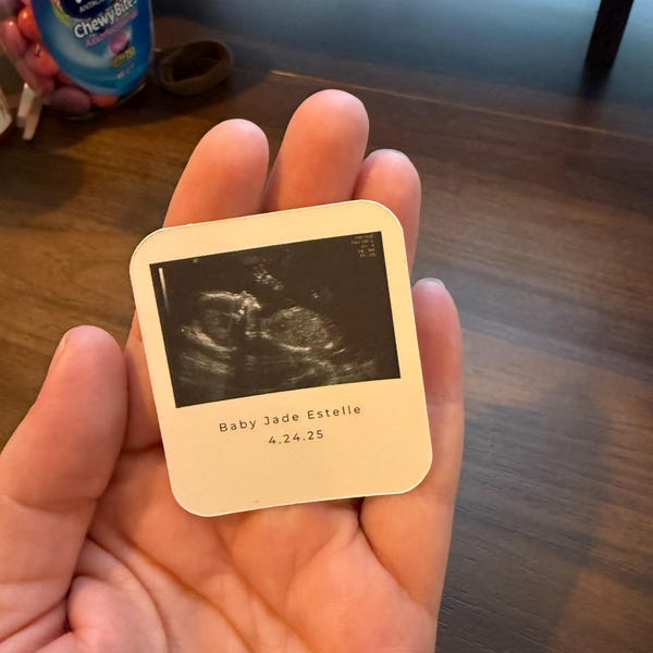 Baby Shower Decorations | Ultrasound Confetti | Custom Decorations Baby ...