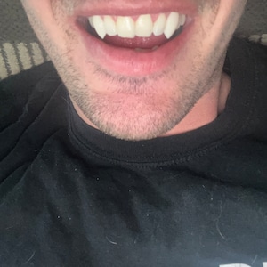 Interview With the Vampire Replica Fangs please Read Item Description ...