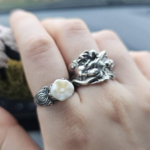 Trio Teeth Ring. Available With/ Without Braces! Gem Cavities Also ...