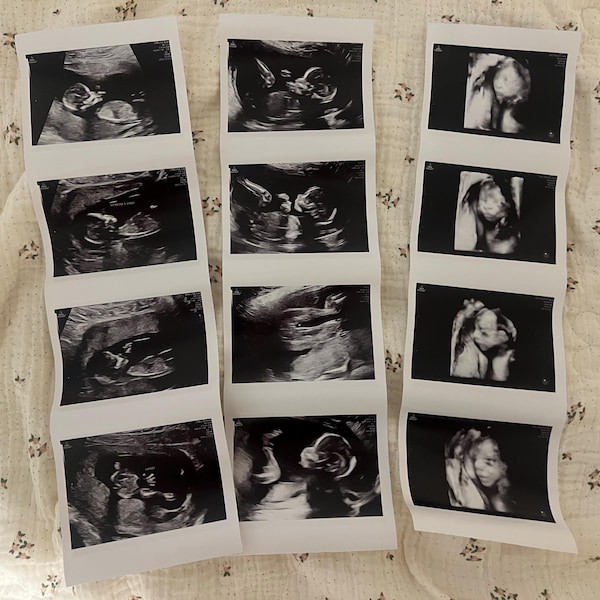 Traditional Ultrasound Strip - Upload Your Digital Images - Etsy