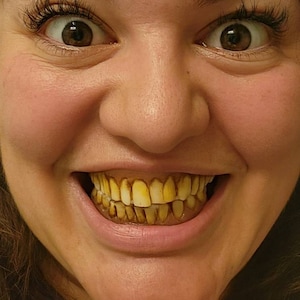 Siren Mermaid Custom Teeth - Etsy