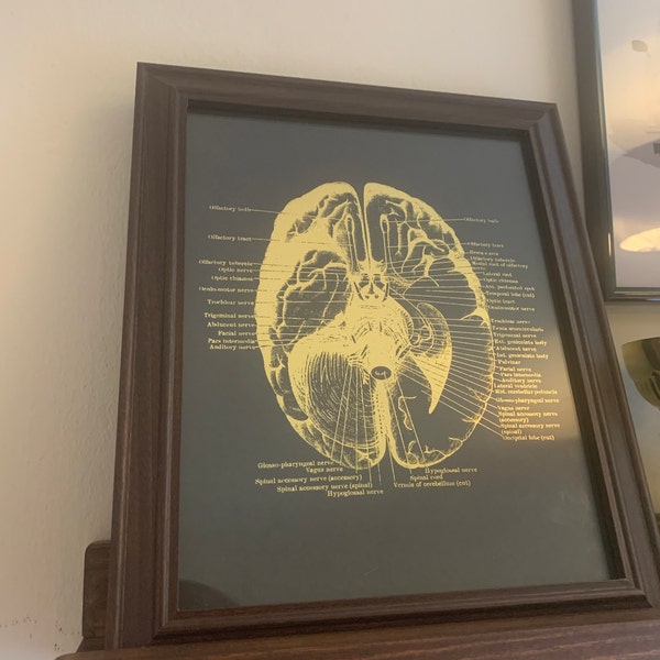 Human Brain Anatomy Medical Student Gift Foil Print - Doctors Office ...