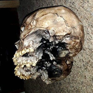 Conjoined Twins Human Skull FREE SHIPPING - Etsy