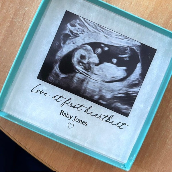 Baby Scan Photo | Baby Scan Frame | Baby Scan Gift | Ultrasound Print ...