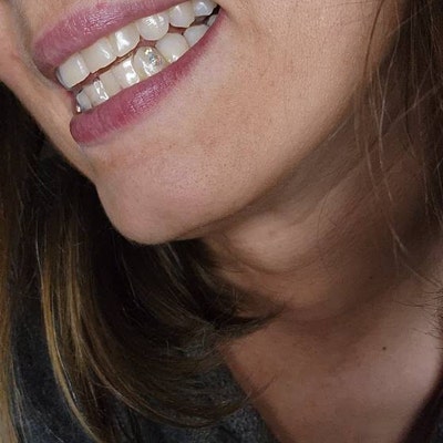 Great Fitting Retainer With Diamonds Customization or Logo.1 Top or ...