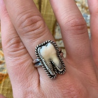 Your Own Custom Tooth Ring! - Etsy