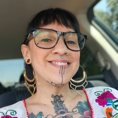 Arthritis Ring for Lateral Deviation, Bending Sideways Finger Splint ...