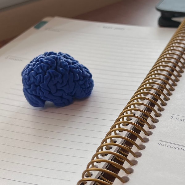 NEURON 3D MODEL | 3D Printed Brain Cell With Internal Cell Body ...