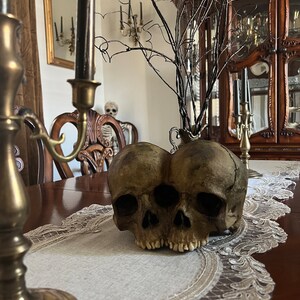 Conjoined Twins Human Skull FREE SHIPPING - Etsy