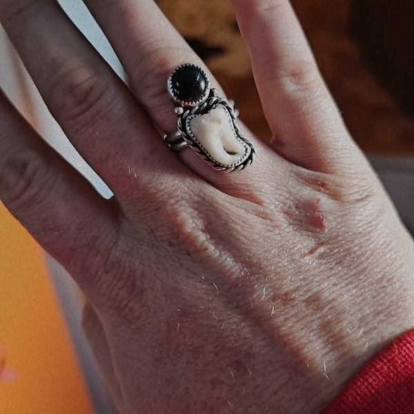 Your Own Custom Tooth Ring! - Etsy