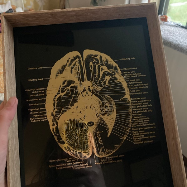 Human Brain Anatomy Medical Student Gift Foil Print - Doctors Office ...