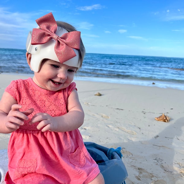 SETS OF 3 BOWS Cranial Helmet Bow Doc Band Bow Starband Bow - Etsy