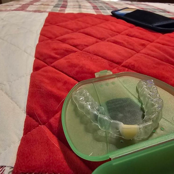 Retainers Customize for a Perfect Fit 1 Save Lots of Money and Office ...