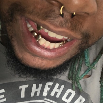 Handmade Custom Dental Gold Top Fangs With Bottom Wolf Style Grillz - Etsy