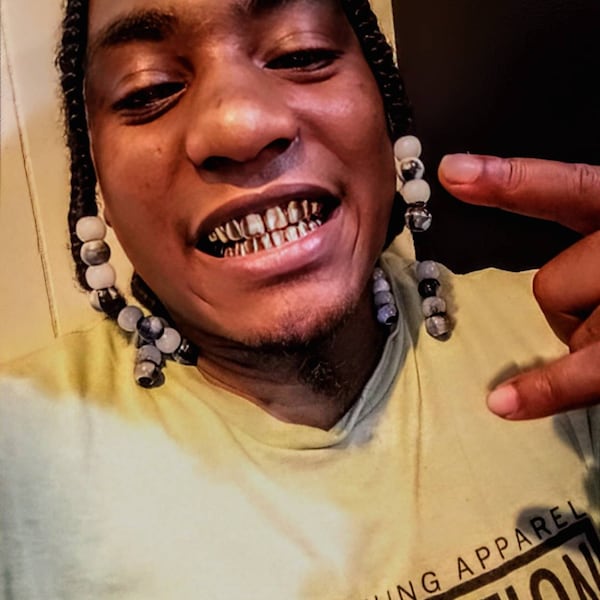 Handmade Custom Permanent Cut Dental Gold Frame Grillz - Etsy