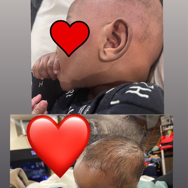 Stimulating Hair Growth Oil Hair Growth Serum Roots 2 Roots for Babies ...