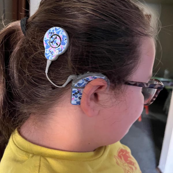 Cochlear Implant Skins for Nucleus 8, Nucleus 7, Sonnet 2, AB Marvel ...