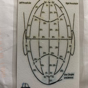 Routine EEG Cheat Sheet - Etsy