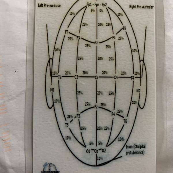 Routine EEG Cheat Sheet - Etsy