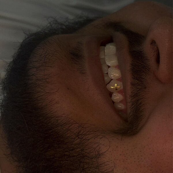 Gold Moon & Star Tooth Gem - Etsy