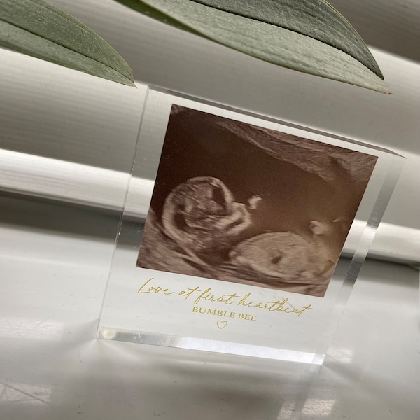 Baby Scan Photo | Baby Scan Frame | Baby Scan Gift | Ultrasound Print ...