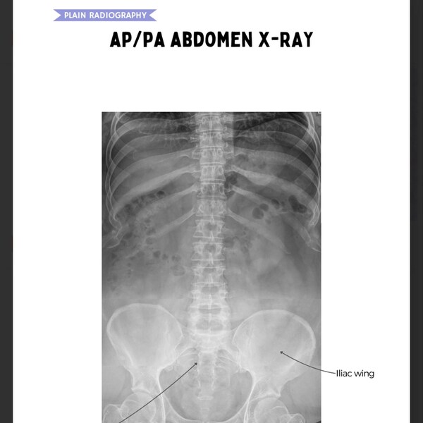 Skull X-ray Anatomy, Pa/caldwell, Om/waters & Lateral, 2025 Radiography ...